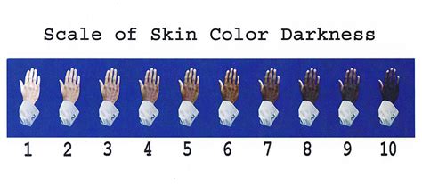 Race Skin Tone Chart