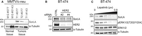 Her2 Targeting Decreases Sorla Levels A Her2‐driven Tumorigenesis