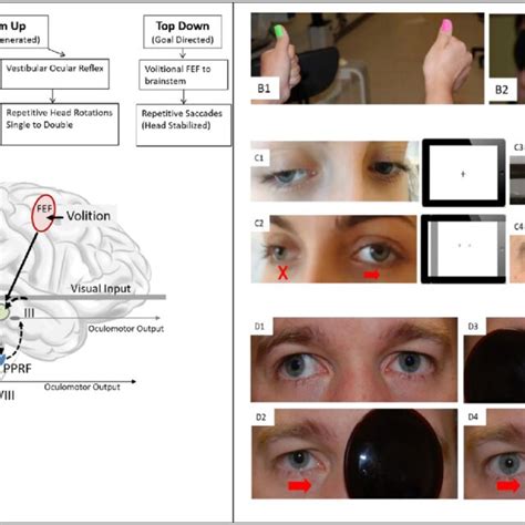 40 Prism Diopter 18° Peli Lens Standard Fitting For Right Download Scientific Diagram