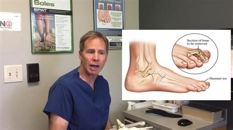 2nd Mtpj Capsulitis Deals Clearance Brunofugaadvbr