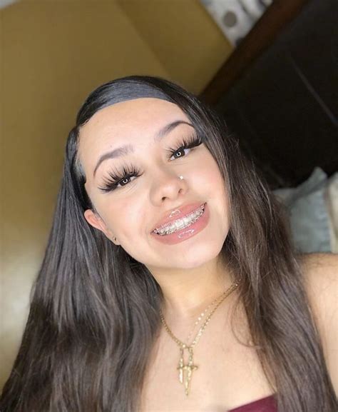 Stunning Braces Color Trends That Are In Right Now Healthy Lifestyle