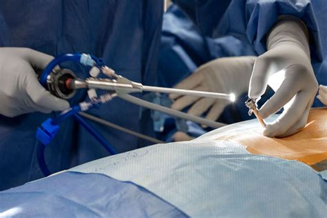 Spine Conditions Cervical Herniated Disc