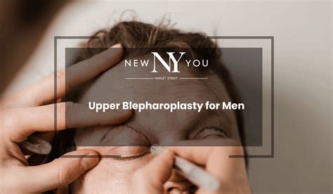 Upper Blepharoplasty For Men — New You Harley Street