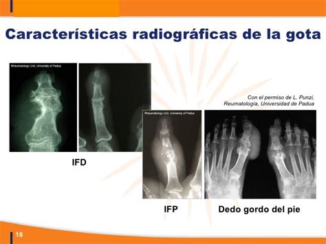 120613 La Gota Pdf