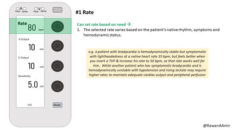 Transvenous Pacing 101