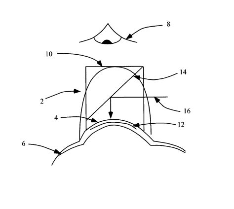 Cornea Surface Patented Technology Retrieval Search Results Eureka Patsnap
