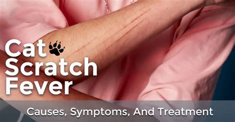 Cat Scratch Fever Causes Symptoms And Treatment