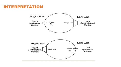 Impedance Audiometrypptx