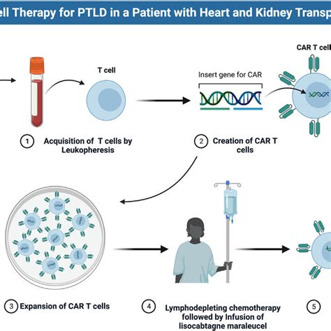 Car T Cell Therapy For Ptld Download Scientific Diagram