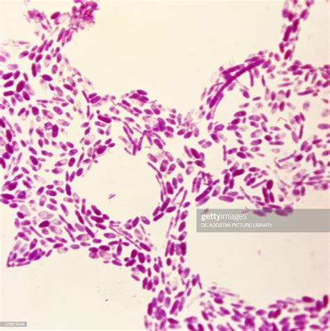 Acetobacter Bacteria Seen Under A Microscope With Counterstaining At