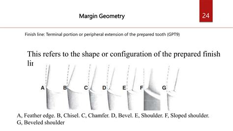 Principles Of Tooth Preparation Pptx