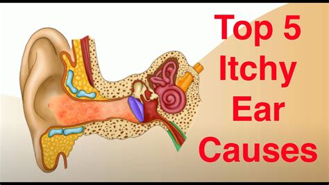 Hearing Aids Itching Ears At George Mcintyre Blog