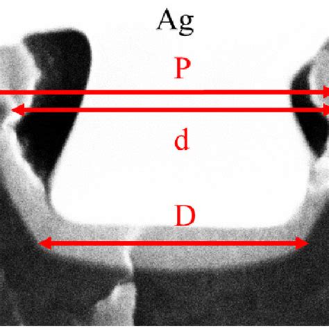 Cross Section Sem Image Of Epi Pecvd Solar Cells Fabricated Using Download Scientific Diagram
