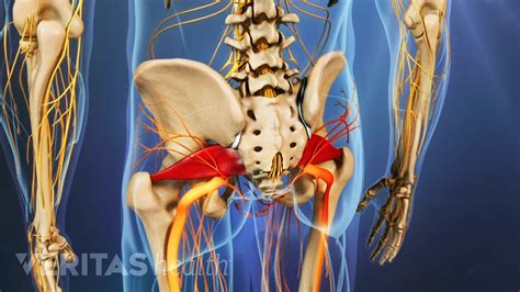 Piriformis Back Pain Piriformis Back Pain