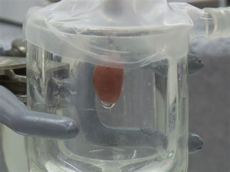 Video Simultaneous Isolation Of High Quality Cardiomyocytes