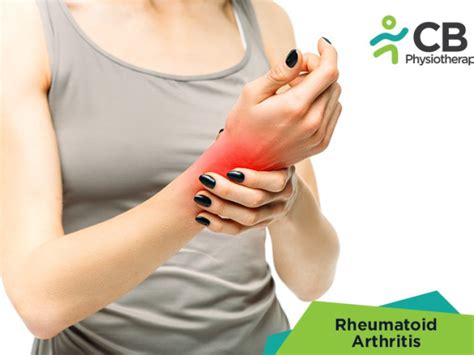 Top 5 Exercises For Rheumatoid Arthritispng