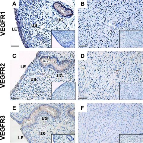 Shows Mrna Expression Of Five Vegf Ligands Vegfa Vegfb Vegfc And Download Scientific