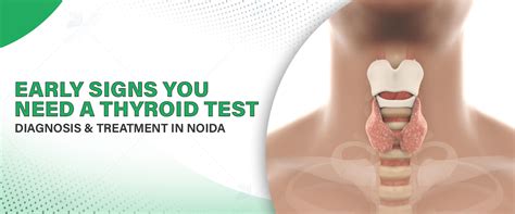 Early Signs You Need A Thyroid Test Diagnosis And Treatment In Noida