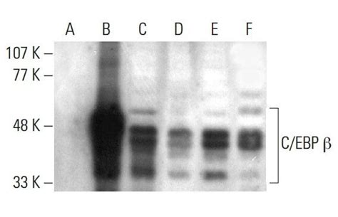 C Ebp β Antibody Δ 198 Scbt Santa Cruz Biotechnology