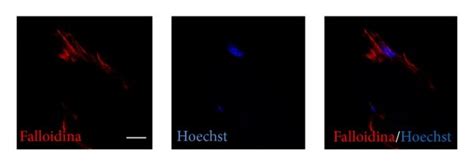 Stem Cell Colonization Growth And Elongation On Monolayer And Bilayer Download Scientific