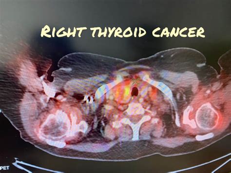 Mumwe Mukadzi Ane Makore 77 Okuberekwa Akabudirira Kurapwa Kune Mbiri