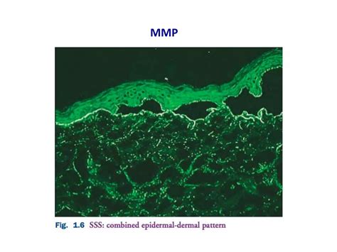 Direct Immunofluorescence In Dermatology Pptx