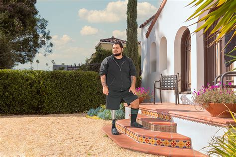 Prosthetic Leg Breakthrough Boosts Mobility Keck Medicine Of Usc