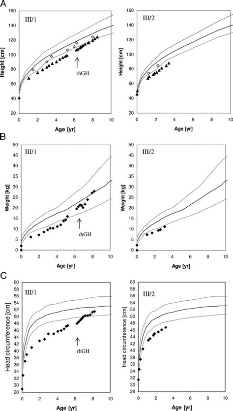 Microcephaly Growth Chart