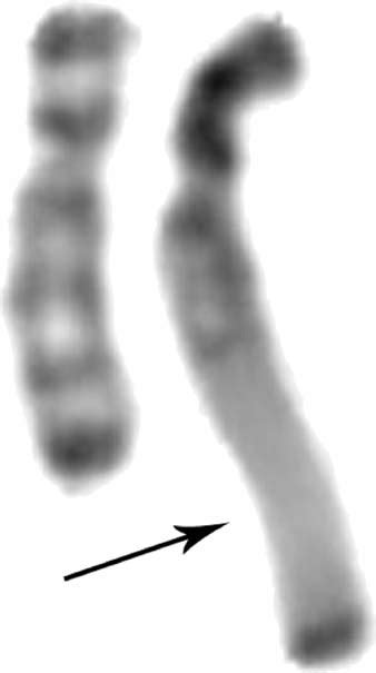 Partial Karyotype The Arrows Indicate The Homogeneously Staining