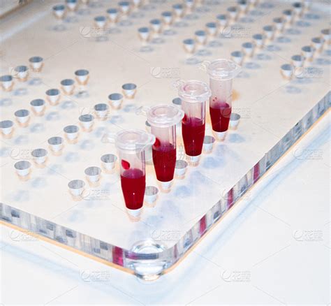 在医学实验室研究血液。
