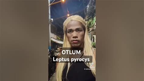 Otlum Leptospirosis Very Very Funny 🤣😜🤣 Otlum Blacklady Veryfunny