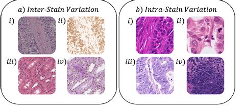 Figure 1 From Stain Consistency Learning Handling Stain Variation For Automatic Digital