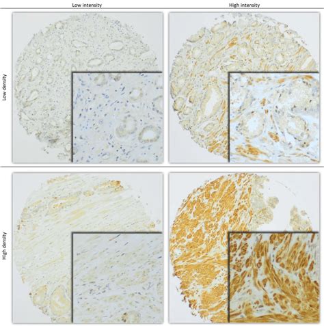 Examples Of High And Low Intensity And Density Of Pdgfr β Download Scientific Diagram Examples Of High And Low Intensity And Density Of Pdgfr β Download Scientific Diagram