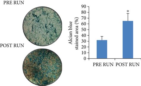 Physical Exercise Improves Chondrogenic Differentiation And Affects