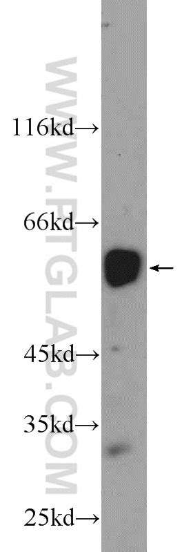 RUNX2 antibody 20700 1 AP Proteintech 武汉三鹰生物技术有限公司