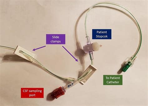 How To Clamp Evd At Hazel Peterson Blog