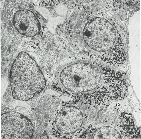 Vesicles Micrograph
