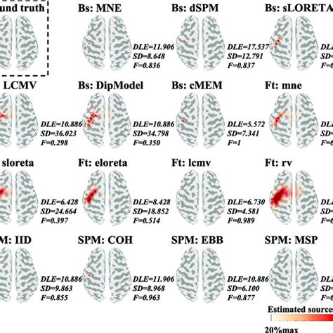 Opm Meg Sensor Configuration And Source Imaging Results Of The