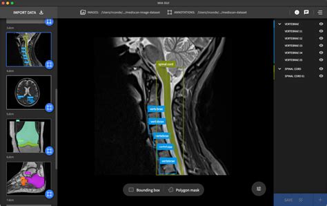Medical Imaging Annotation Emerging Analytics Center