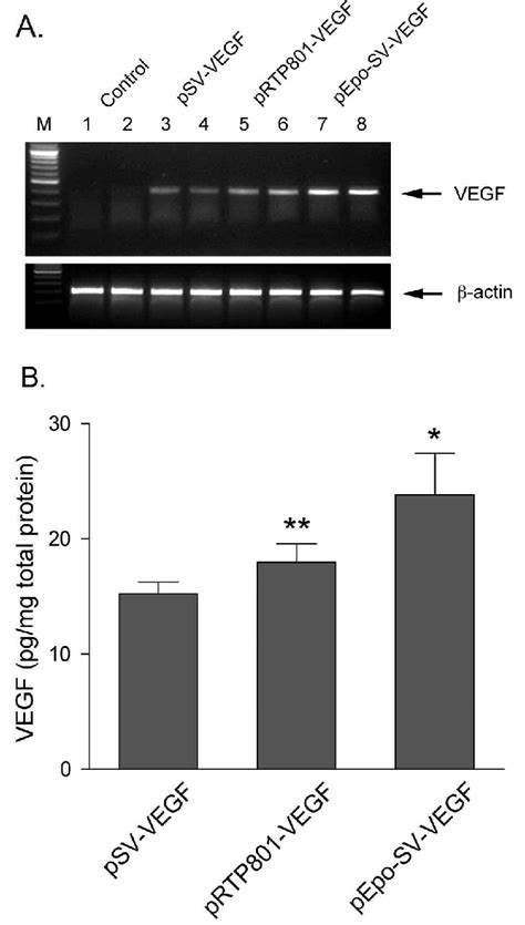 Gel Electrophoresis A And Bar Graph B Showing The Expression Of