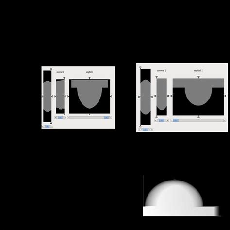 The Flowchart Of Proposed Method To Reduce Boundary Artifacts Of The
