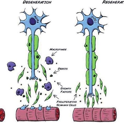 Wallerian Degeneration Wd Steps Download Scientific Diagram