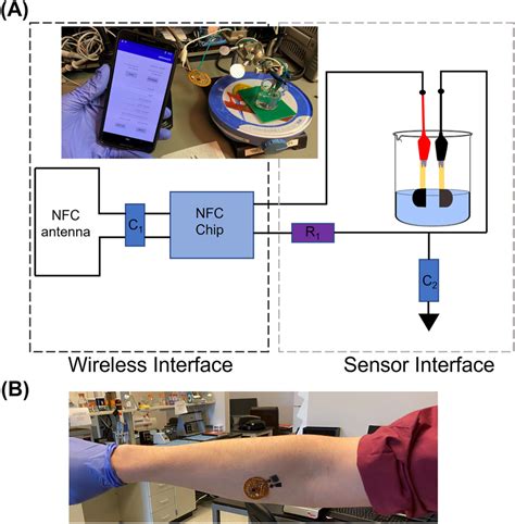A Schematics Of The Glucose Monitoring System Comprising A Glucose