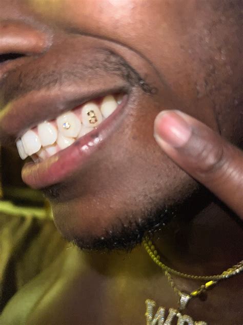 Custom Gold Tooth Gem Etsy