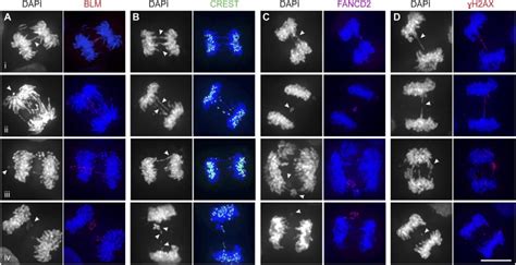 Roles Of Slx1slx4 Mus81eme1 And Gen1 In Avoiding Genome Instability