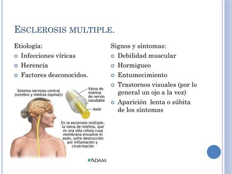 Ppt Cuidados De Enfermería A Pacientes Con Trastornos Del Snp Powerpoint Presentation Id 1917662