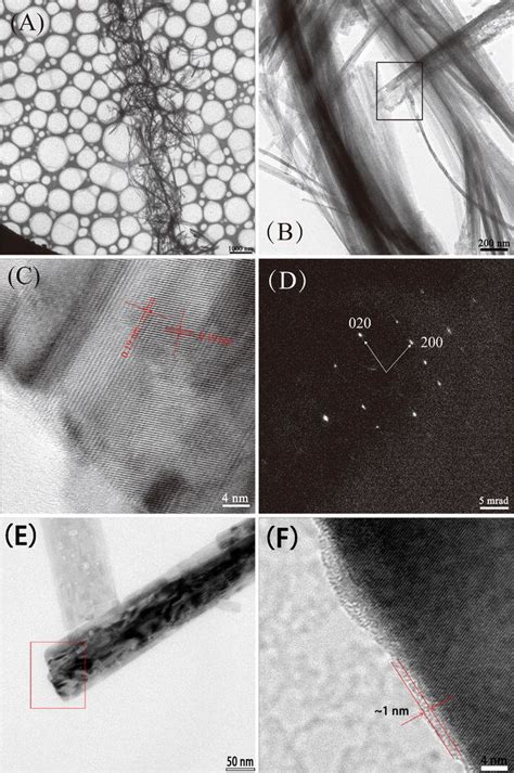 A Tem Image Of The Overall Ntb B Tem Image Of The Regional Ntb From A Download Scientific
