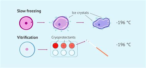Mastering Oocyte And Embryo Vitrification In Assisted Reproductive