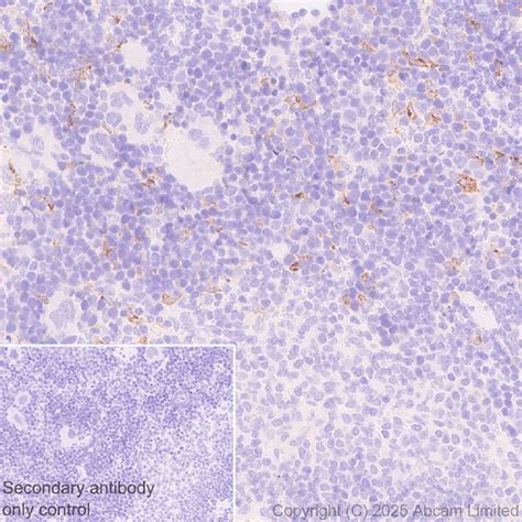 Anti Cd5lct 2 Antibody Epr29364 21 Ab324193 Abcam