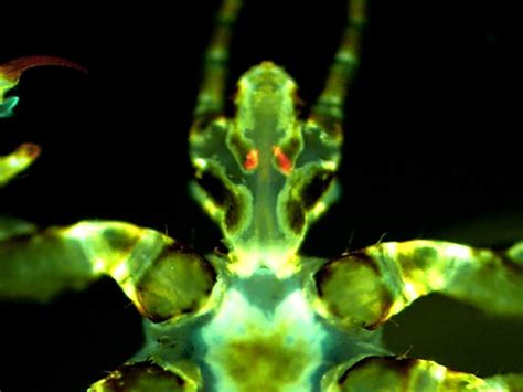 Dont Just Blame Rat Fleas Lice May Have Helped Spread Black Death Plague Npr Illinois